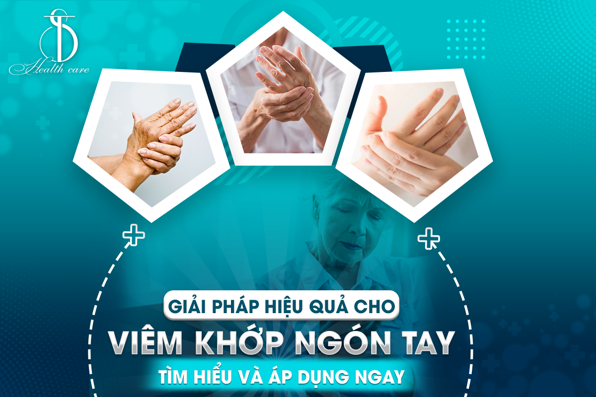 Giải Pháp Hiệu Quả Cho Viêm Khớp Ngón Tay: Tìm Hiểu và Áp Dụng Ngay