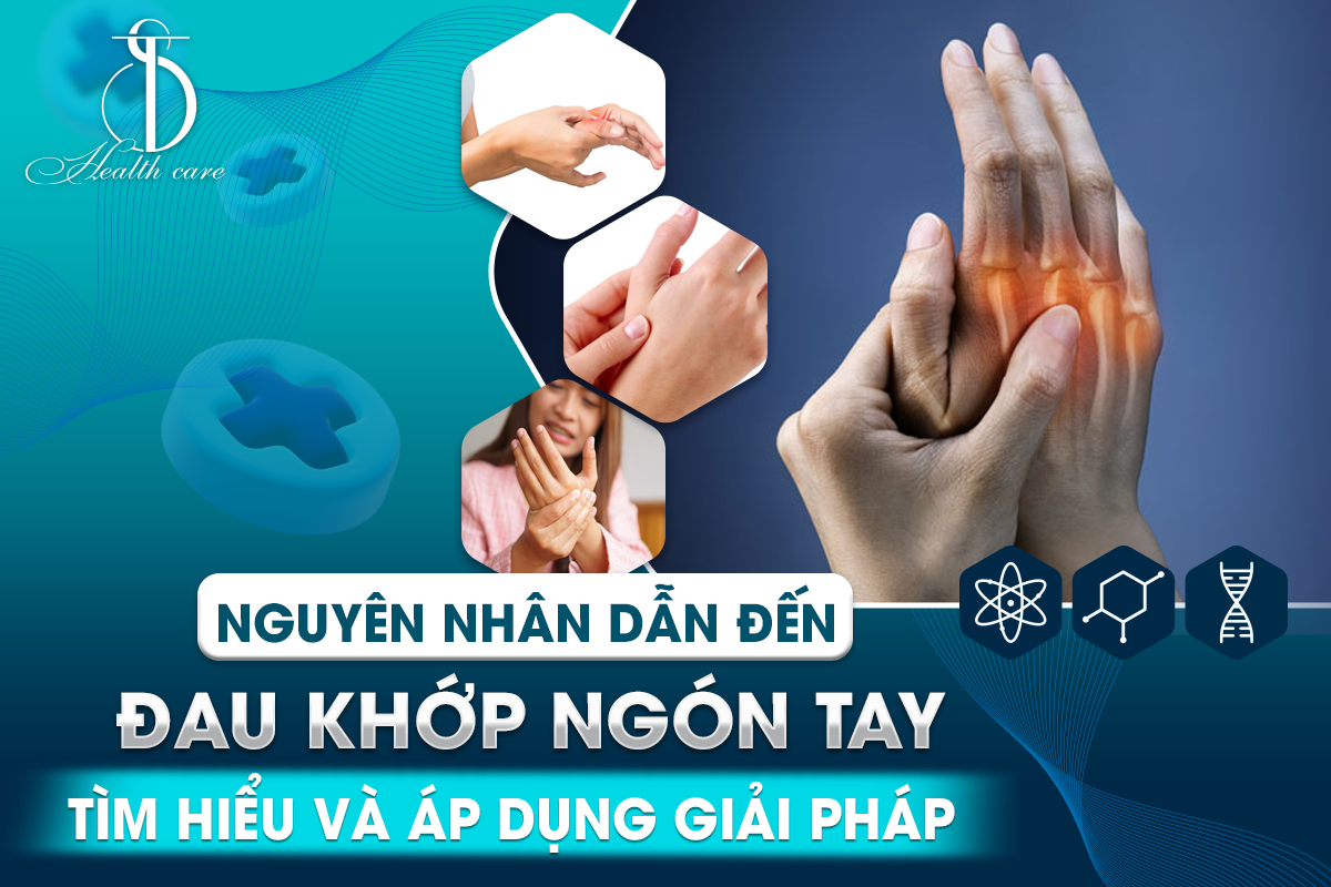 Nguyên Nhân Dẫn Đến Đau Khớp Ngón Tay: Tìm Hiểu và Áp Dụng Giải Pháp